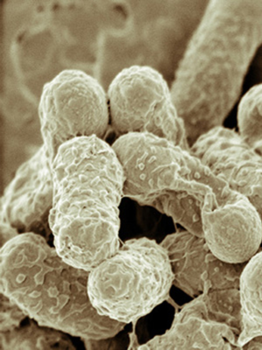 'Silent Pandemic' Threatens to Turn Back Century of Medical Progress ...