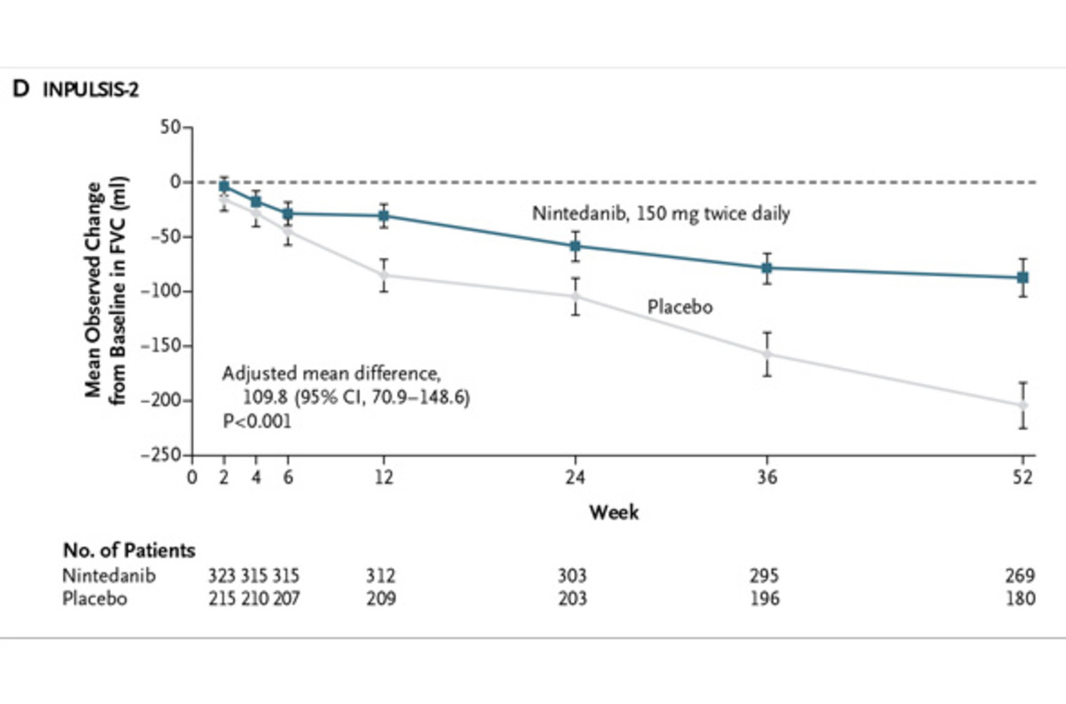 Lung Drug Data Showdown: InterMune vs. Boehringer Ingelheim - TheStreet