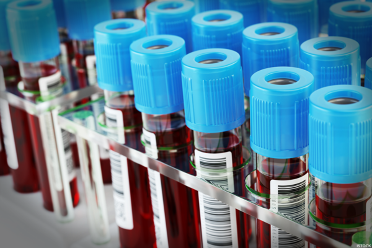 Bioverativ (BIVVV) Makes Splash in Trading Debut, Gaining 18% on Day ...