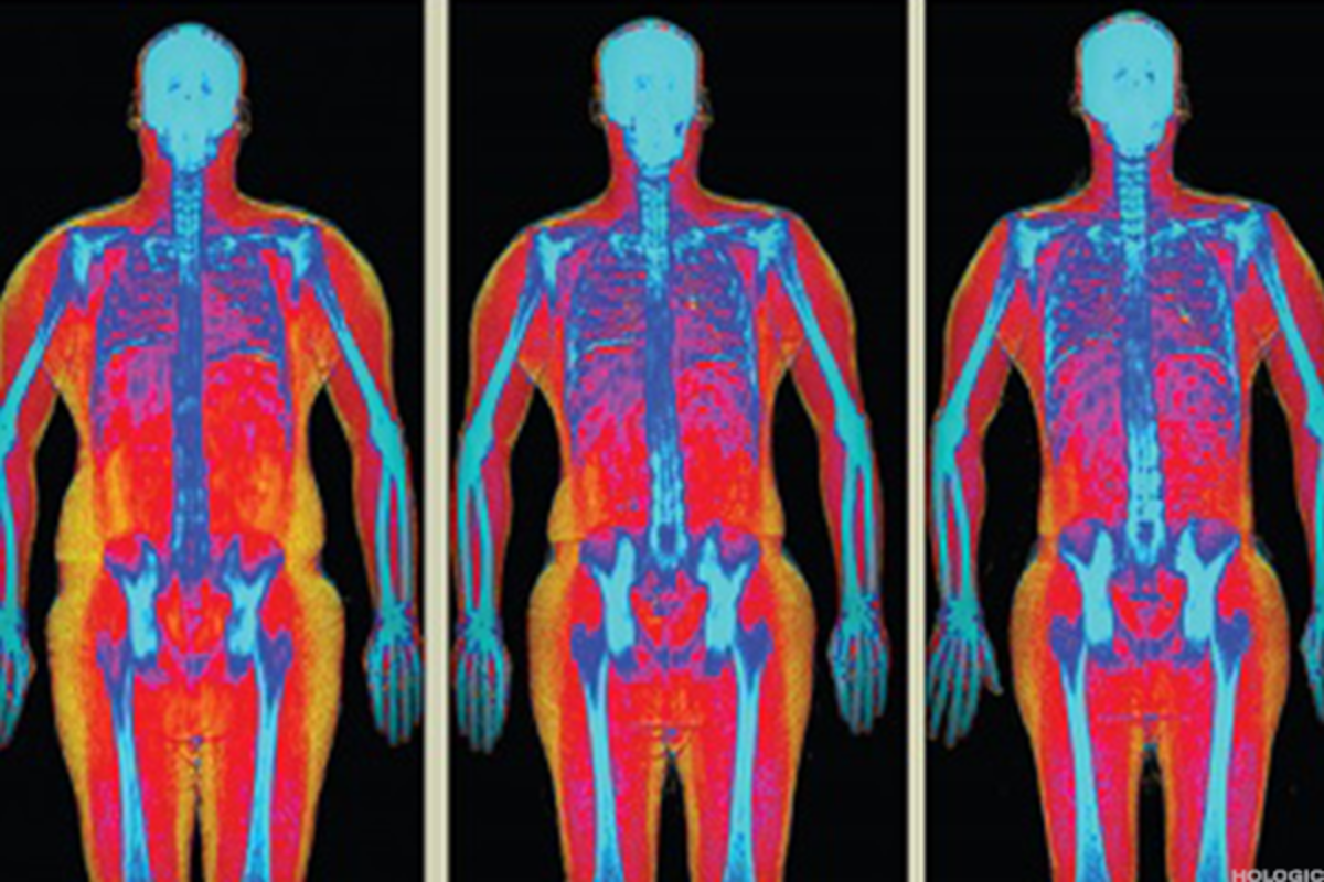 Will Illumina (ILMN) Maintain This Feverish Pace? Chart Shows What's ...