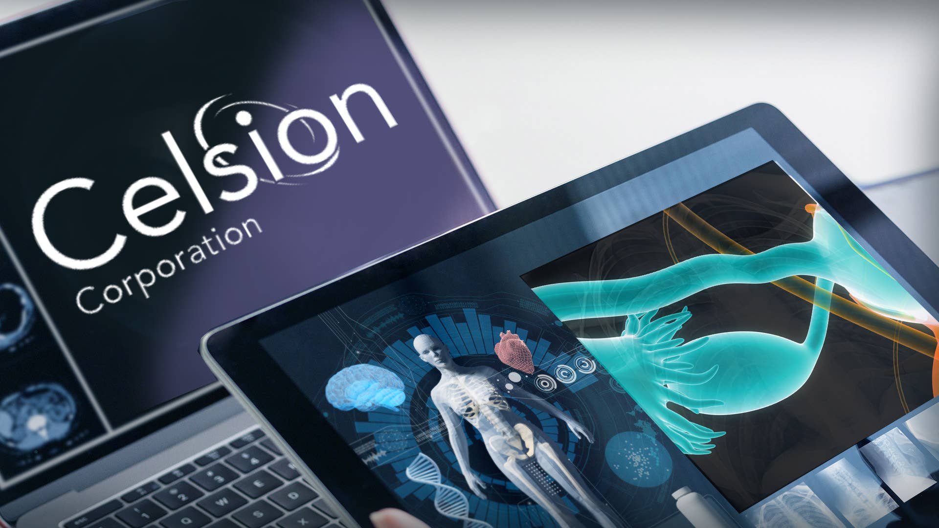 Celsion Surges as FDA Fast-Tracks Ovarian-Cancer Drug - TheStreet