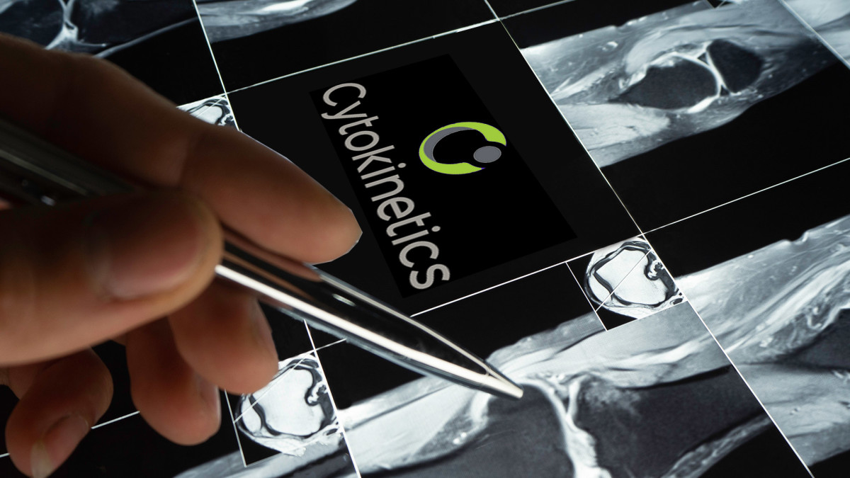 Cytokinetics Soars on Positive Results of Heart Disease Treatment Test ...